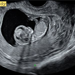 CCRM FERTILITY - MINNEAPOLIS - Updated December 2025 - 13 Photos & 10 ...