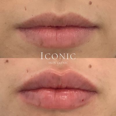 ICONIC SKIN CLINIC- DOWNEY - Updated June 2026 - 33 Photos & 64 Reviews ...