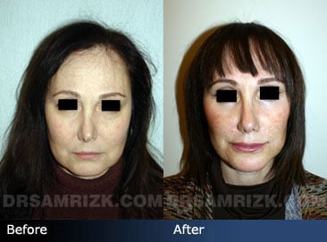 SAM RIZK, MD - Updated October 2025 - 102 Photos & 63 Reviews - 1040 ...