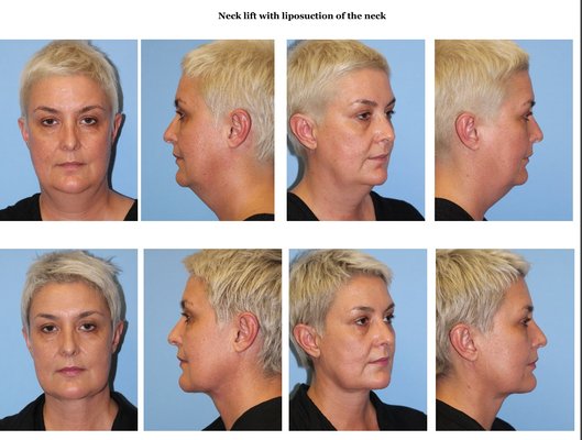 JIMMY S. FIROUZ, MD, FACS - 167 Photos & 371 Reviews - 416 N Bedford Dr ...