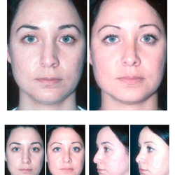 JAMES L PERTSCH, MD - 33 Photos & 39 Reviews - 34 N San Mateo Dr, San ...