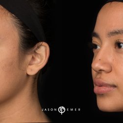 JASON EMER, MD - 914 Photos & 365 Reviews - Dermatologists - 9201 ...