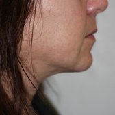 KEITH DENKLER, MD - 10 Photos & 51 Reviews - Cosmetic Surgeons - 275 ...