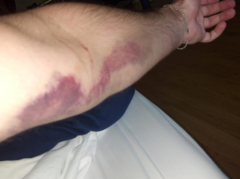 LABORATORY CORPORATION OF AMERICA PATNT SRVCE CTRS - Updated June 2025 ...