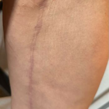 BRIAN M PARRETT, MD - Updated August 2025 - 73 Reviews - 2351 Clay St ...