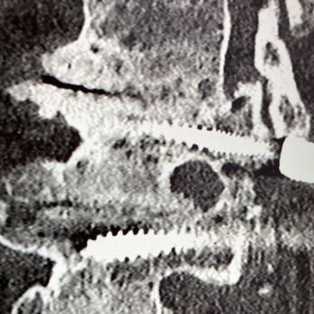 GORDON TANG, MD - EAST BAY NEUROSURGERY & SPINE - Updated December 2025 ...