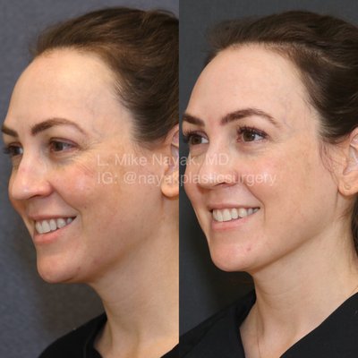 NAYAK PLASTIC SURGERY - Updated January 2025 - 266 Photos & 32 Reviews ...