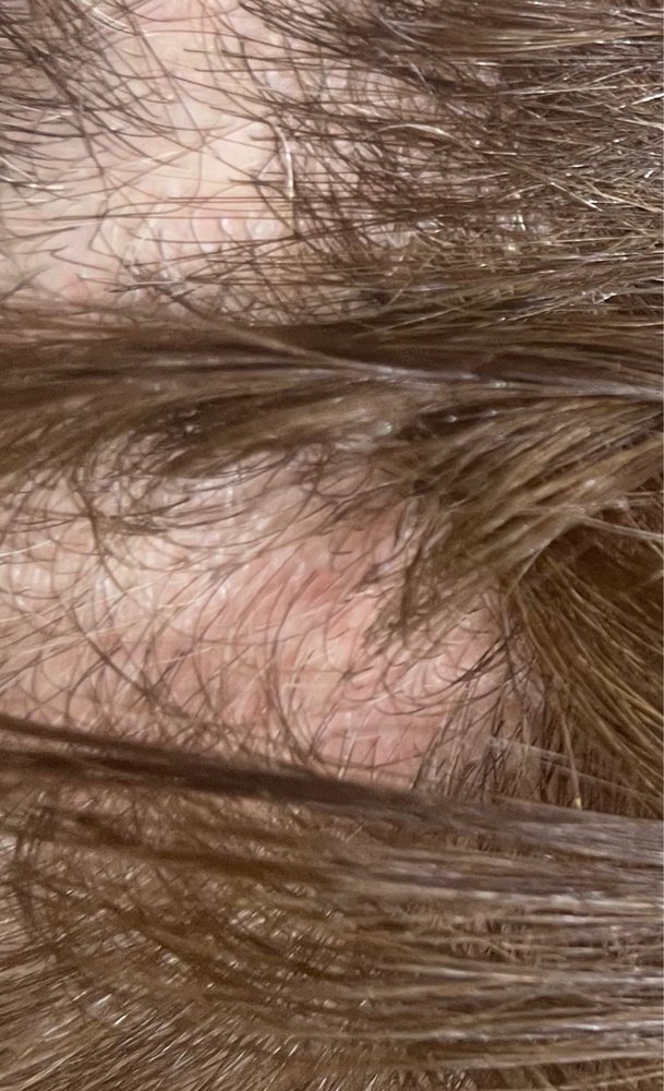 CLEMENS ESCHE, MD, FAAD - Updated October 2025 - 16 Reviews - 6155 ...