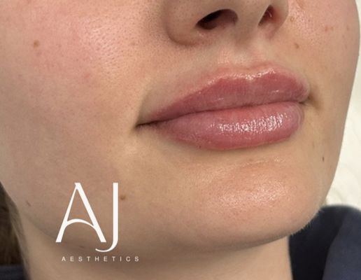 ANNE JUDGE AESTHETICS - Updated January 2025 - 41 Photos - 454 ...