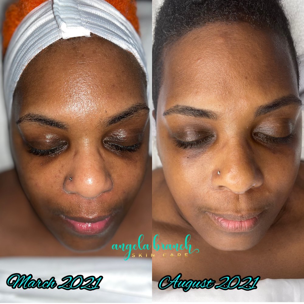 ANGELA BRANCH SKIN CARE - Updated July 2025 - 35 Photos - 145 Court St ...