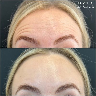 ALEXANDRA PALUMBO, DNP - BLONDE GIRL AESTHETICS - Updated July 2025 ...