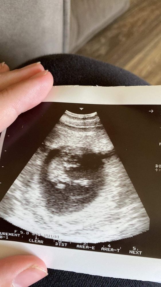 HAVEN HEALTH CLINIC - Updated October 2024 - 311 Redmond Rd, Rome ...