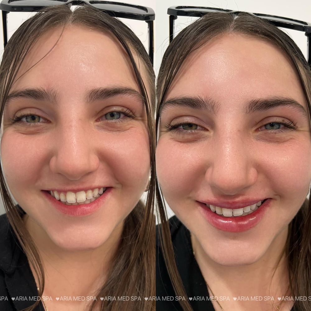 ARIA MED SPA - Updated October 2024 - 1481 Belleair Rd, Clearwater ...