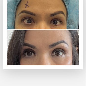 MEHRYAR RAY TABAN MD - OCULOPLASTIC SURGEON - Updated September 2025 ...