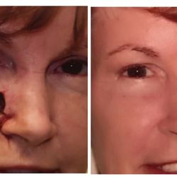 BRADLEY BECKER PLASTIC AND RECONSTRUCTIVE SURGERY - 48 Photos - 18555 N ...