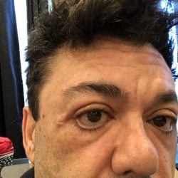 GUY MASSRY, MD - 146 Photos & 124 Reviews - 150 N Robertson Blvd ...