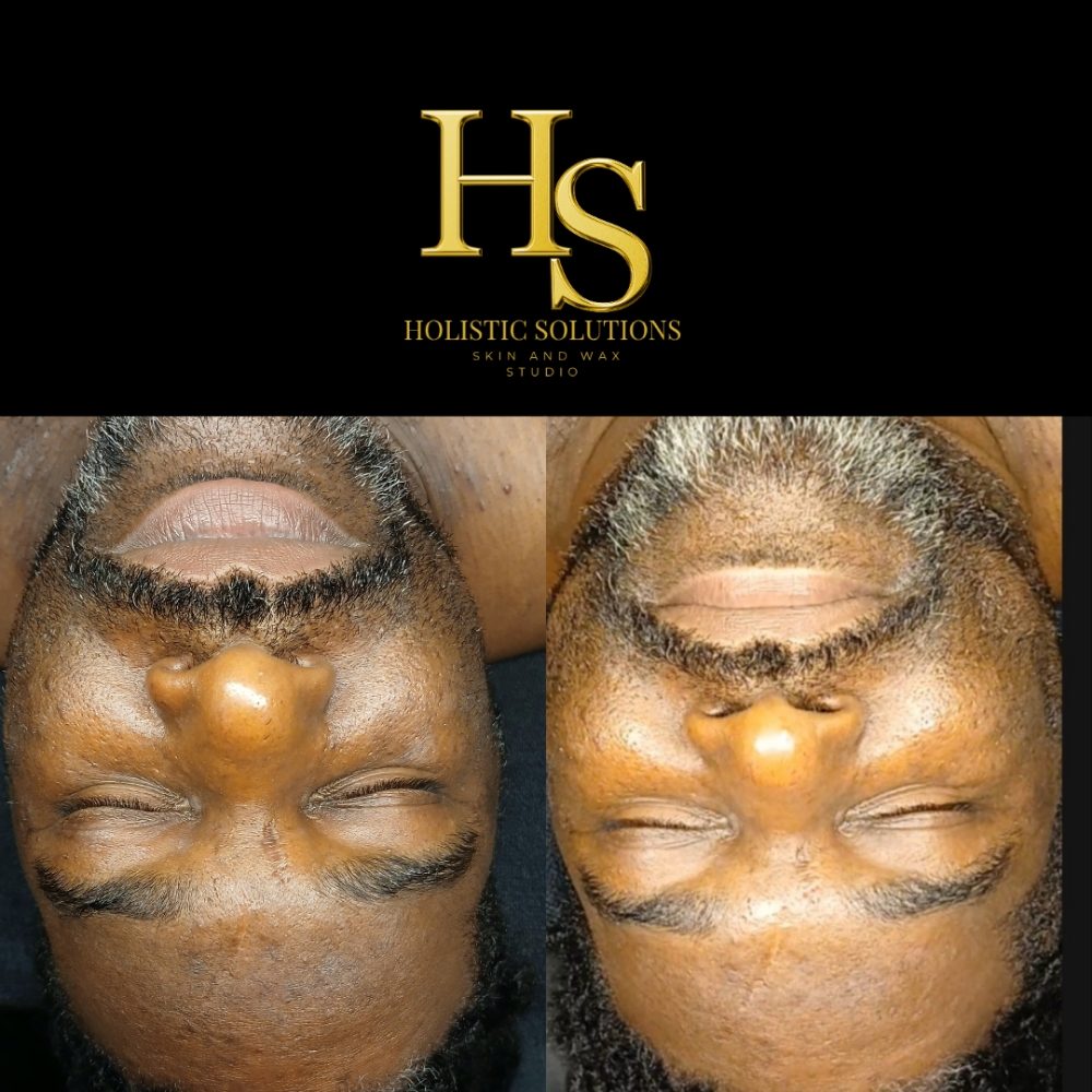 HOLISTIC SOLUTIONS SKIN AND WAX STUDIO - Updated September 2025 ...