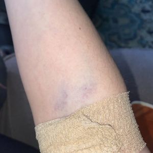 ST ELIZABETH IMAGING CENTER - Updated December 2025 - 2200 Conner Rd ...