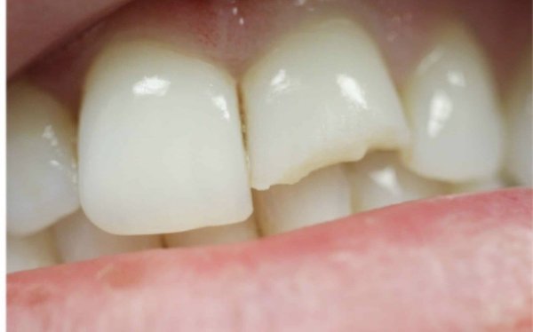 GOLD COAST DENTAL - SAN GABRIEL - Updated December 2025 - 22 Photos ...