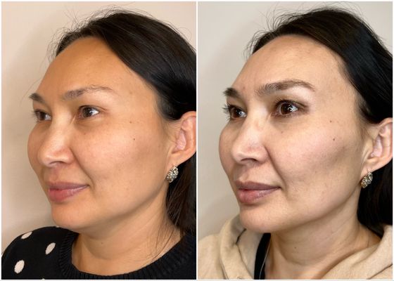 PROLASE MEDISPA - Updated July 2024 - 696 Photos & 118 Reviews - 313 ...