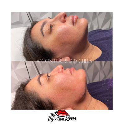 THE INJECTION ROOM - Updated December 2025 - 139 Photos & 60 Reviews ...