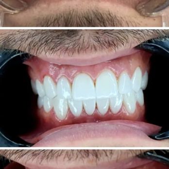 CG SMILE - 45 Photos & 28 Reviews - 2601 SW 37th Ave, Miami, Florida ...