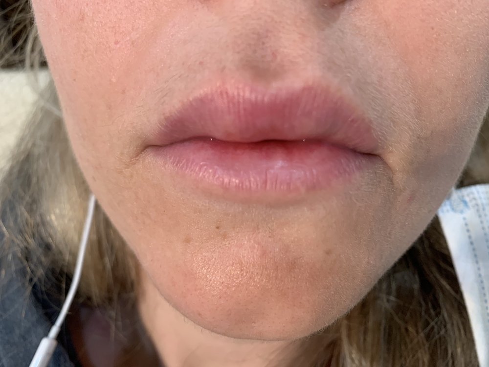 AZAR PLASTIC SURGERY & MED SPA - Updated June 2024 - 86 Photos & 92 ...