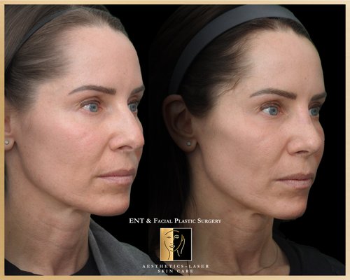 ENT FACIAL PLASTIC SURGERY EDNAN MUSHTAQ, MD, FACS - Updated December ...