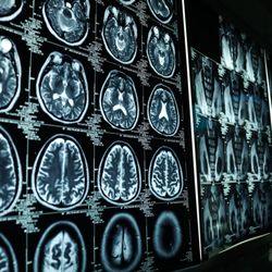 SPECTRUM MRI IMAGING CENTER - 18 Photos & 30 Reviews - Diagnostic ...