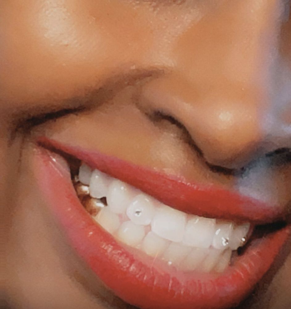 ELEGANT TOOTH WHITENING & GEMS - Updated November 2024 - Request an ...