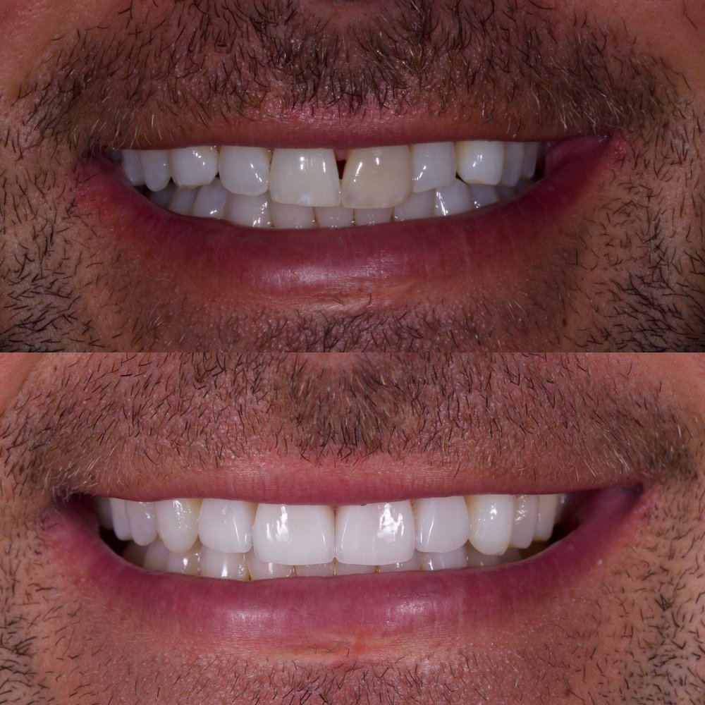 DAN PINAR, DDS - 11 Photos & 65 Reviews - Endodontists - 8733 Beverly ...