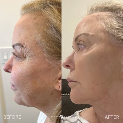 JASON EMER, MD - Updated January 2025 - 1108 Photos & 503 Reviews ...