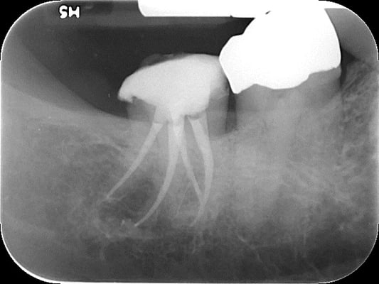 ROOTVISION ENDO - Updated January 2026 - 54 Photos & 212 Reviews - 3663 ...