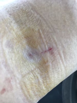 BIOLIFE PLASMA SERVICES - Updated December 2025 - 33 Photos & 119 ...