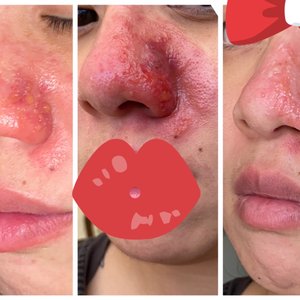 QUAN NGUYEN, MD - Q-DERMATOLOGY - Updated December 2025 - 45 Reviews ...