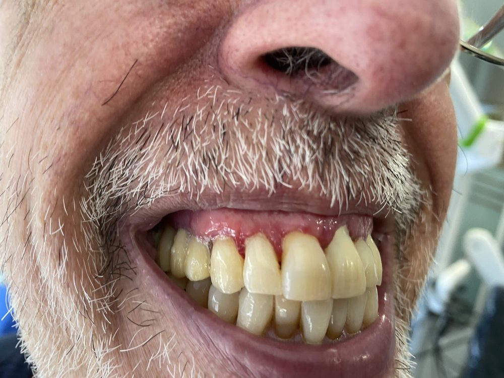 JUSTIN RAANAN, DDS MMSC PERIODONTIST BEVERLY HILLS - Updated February ...