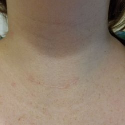 CLAYMAN THYROID CENTER - 39 Photos & 73 Reviews - 5959 Webb Rd, Town 'n ...