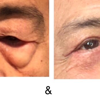 STEVEN J YOON MD - Updated October 2025 - 5363 Balboa Blvd, Los Angeles ...