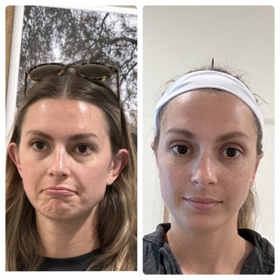 TOFT FACIAL PLASTIC SURGERY - Updated October 2025 - 21 Photos & 63 ...