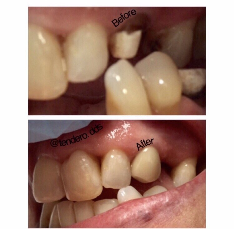 JESSICA TENDERO, DDS - Updated January 2026 - 50 Photos & 11 Reviews ...