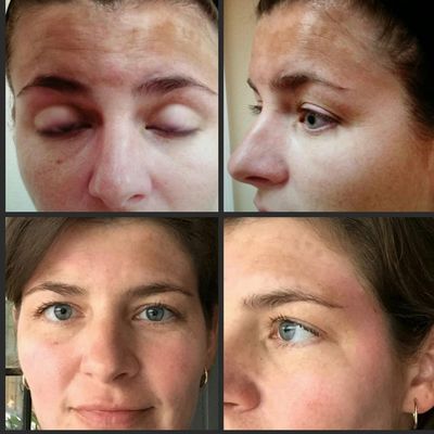 MIDSTATE SKIN INSTITUTE - Updated December 2025 - 34 Photos & 15 ...