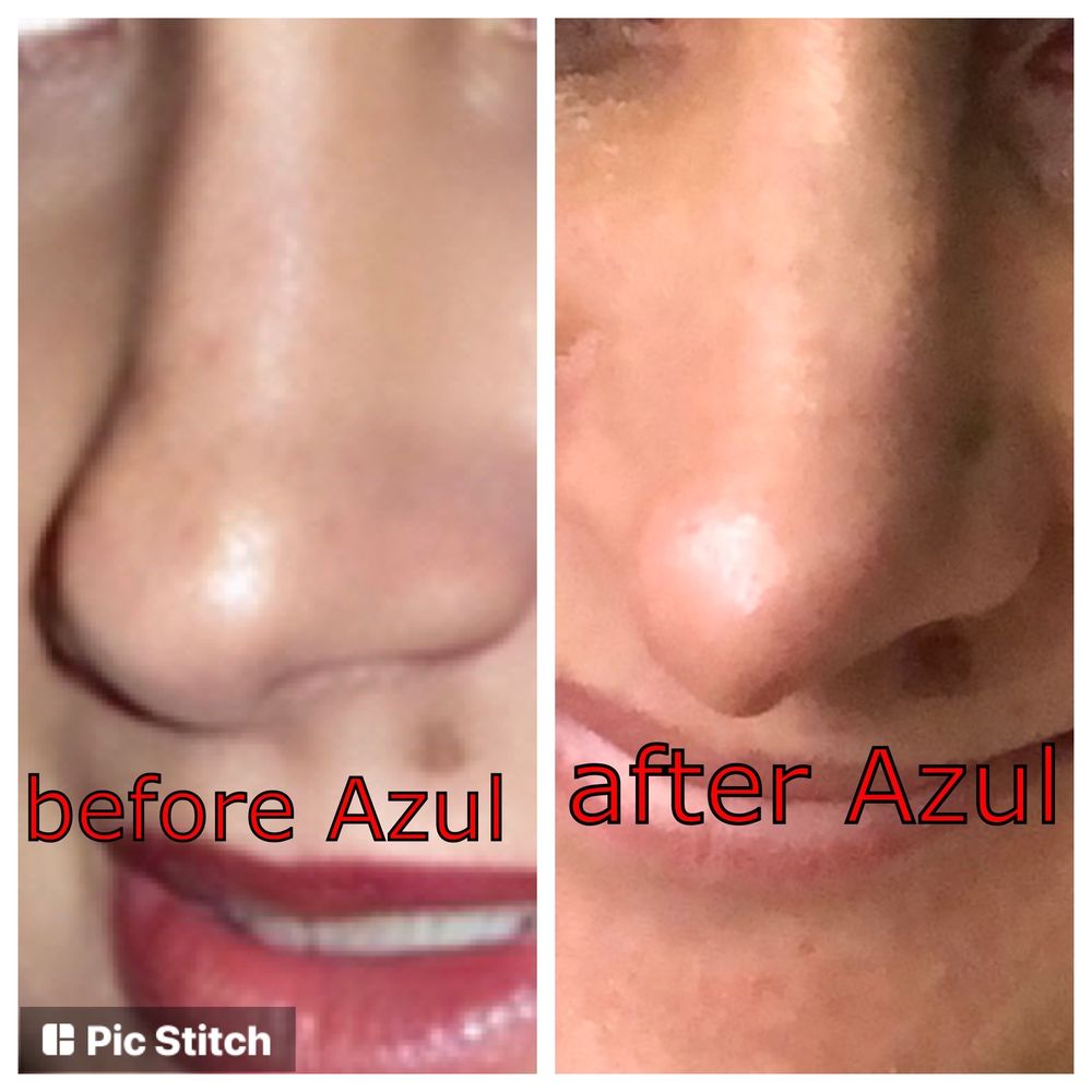 AZUL PLASTIC SURGERY - Updated January 2026 - 38 Photos & 22 Reviews ...