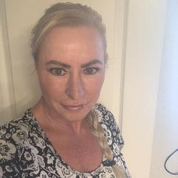 PERFECTION PLASTIC SURGERY & SKIN CARE - 23 Photos & 28 Reviews ...