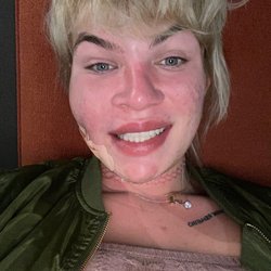 BEVERLY HILLS TRANSGENDER SURGERY: DR. ALEXANDER SINCLAIR - 57 Photos ...