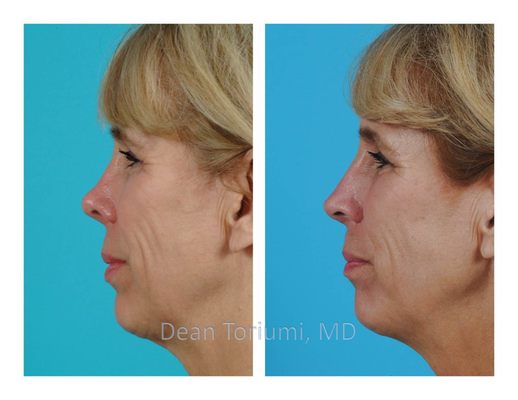 DEAN TORIUMI, MD - Updated August 2024 - 50 Photos & 40 Reviews - 60 E ...