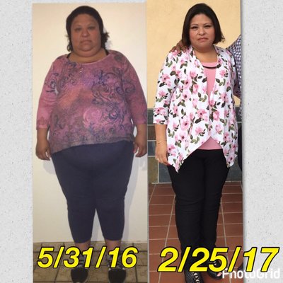 ATIF IQBAL MD - NEW LIFE SURGERY - Updated October 2025 - 56 Photos ...