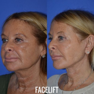 ASHKAN GHAVAMI, MD - Updated December 2025 - 242 Photos & 165 Reviews ...