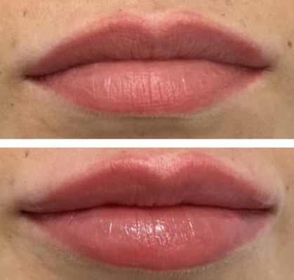 PERFECTION PLASTIC SURGERY & SKIN CARE - Updated December 2025 - 23 ...