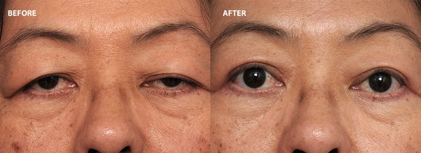 DAVID CHO, MD - Updated December 2025 - 36 Photos & 42 Reviews - 888 S ...