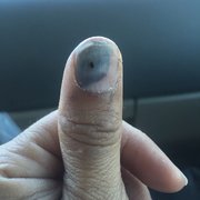 UPPER VALLEY URGENT CARE CENTER - Updated December 2025 - 15 Photos ...